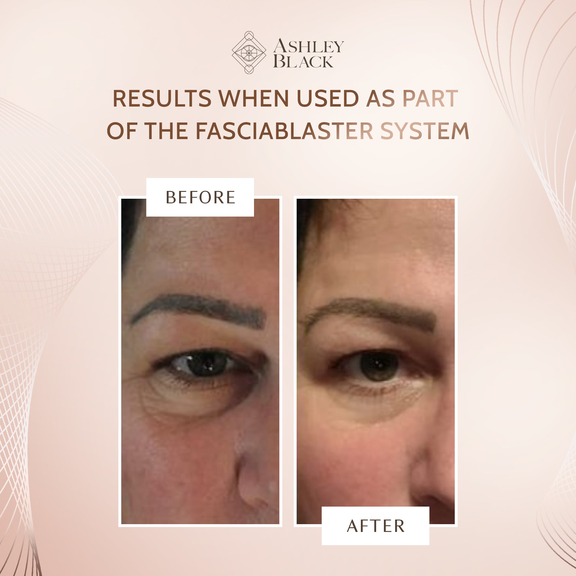 Fine Line Eraser With Handle – fasciablasterwholesale